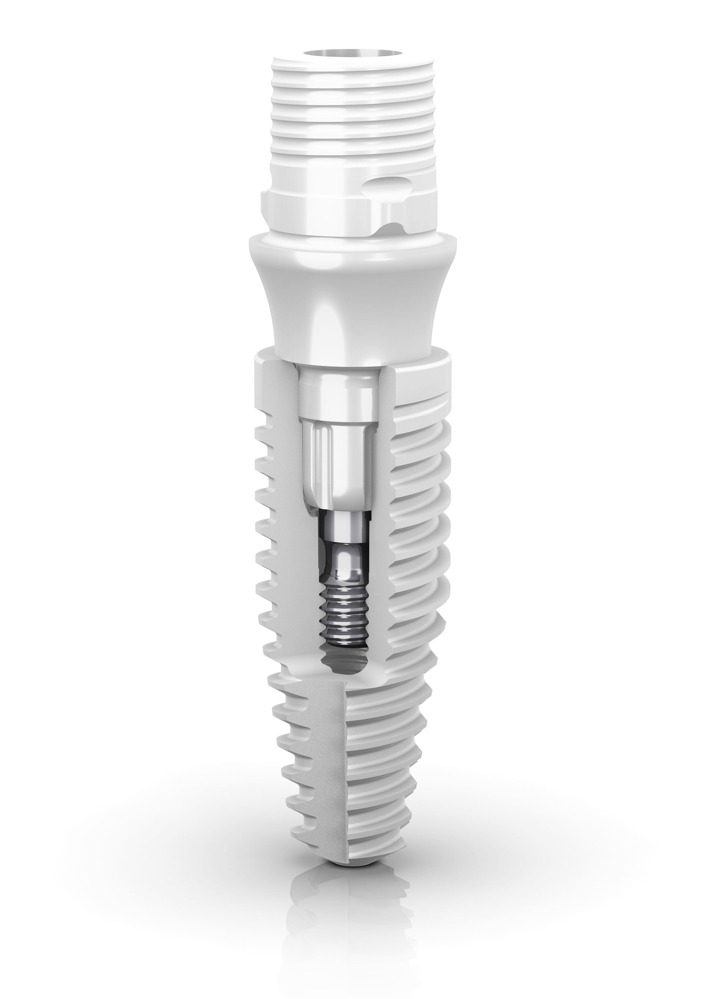 Neodent Zi Keramik-Implantatsystem: Eine Lösung für neue Herausforderungen